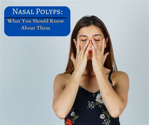 Nasal Polyps What You Should Know About Them