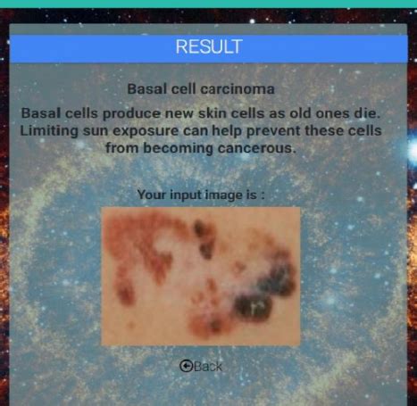SKIN DISEASE DETECTION Project In Python With Source Code And Report Download Kashipara