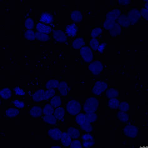 Dirty DAPI Staining After Transfection On Poly Lysine Coated Slides