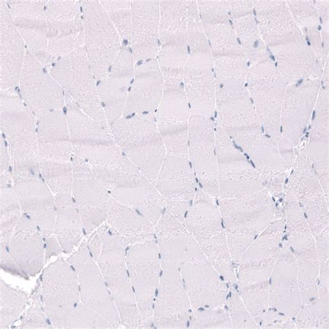Anti Eys Human Protein Atlas Antibody