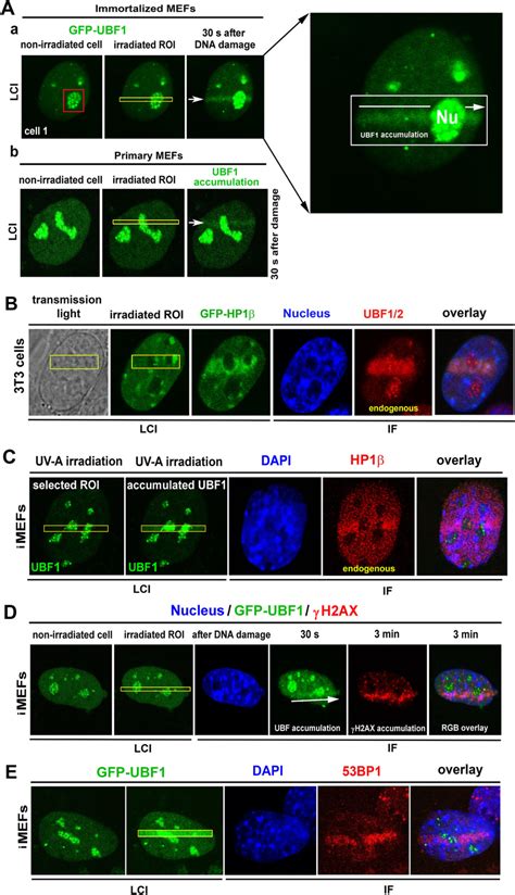 Recruitment Of Gfp Ubf1 Hp1β γh2ax And 53bp1 To Uva Induced Dna