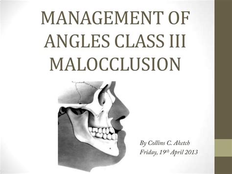 3management Of Angles Class Iii Malocclusion Pptx