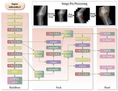 Enhancing Yolov11 With Large Kernel Attention And Multi Scale Fusion