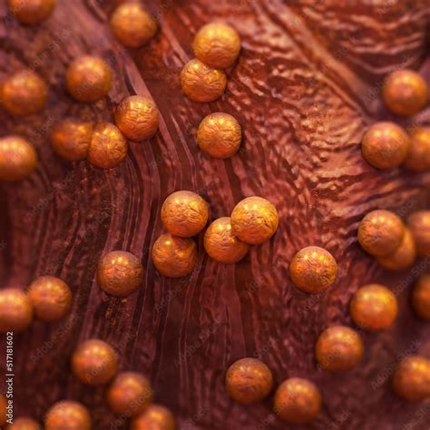 Medical Background Staphylococcus Aureus A Type Of Spherical Gram