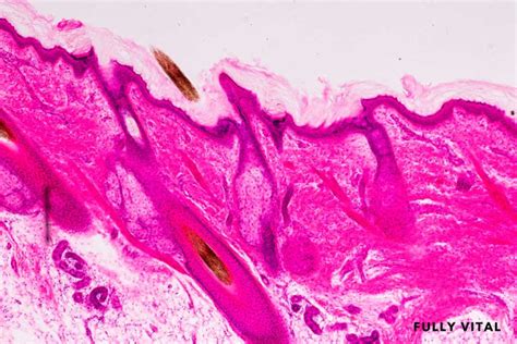 Scalp Biopsy Understanding The Importance And Alternatives