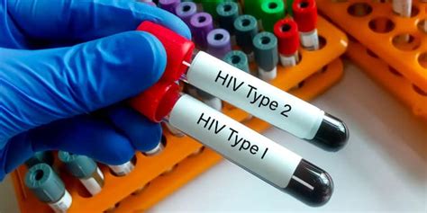 Understanding Hiv 1 Vs Hiv 2 Key Differences Explained