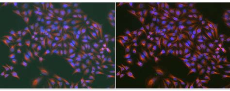 Advancing Live Cell And Time Lapse Imaging With Digital Microscopy