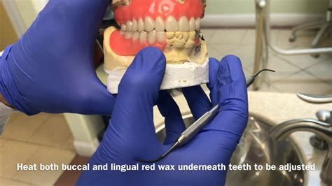 How To Put Wax On Your Teeth At Rachel Enderby Blog