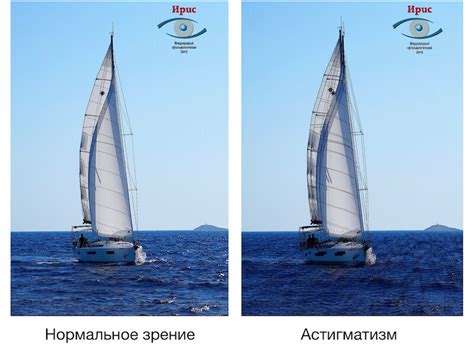 Смешанный астигматизм у детей и взрослых причины и лечение в Красноярске Офтальмологический