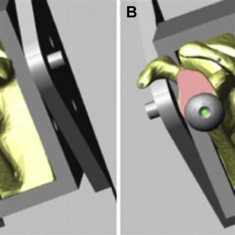 Glenosphere Position Resultant Of The Resting Face Of The Glenoid In