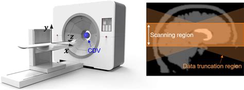 Illustration Of The G Spect I Scanner The Left Image When A Download Scientific Diagram