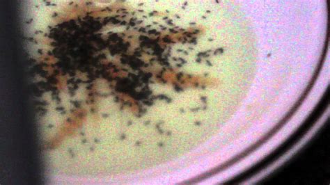 How To Get Rid Of Fleas YouTube