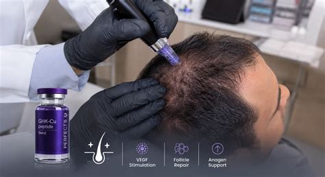 Peptides For Hair Growth Clinical Guide Perfect B