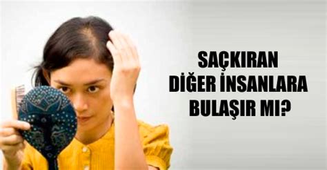 Saçkıran Bulaşıcı Bir Hastalıkmı dır