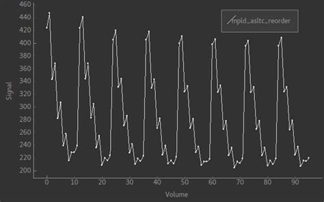 Asl Preprocessing — Quantiphyse Documentation