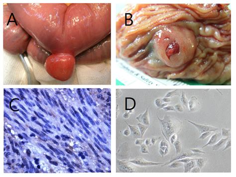 Macroscopic And Microscopic Inspection Of Gist Tumor A Small Download Scientific Diagram