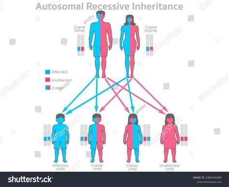 Autosomal Recessive Over 386 Royalty Free Licensable Stock Illustrations And Drawings Shutterstock