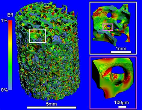 Bone Simulations To Aid Diagnosis Of Osteoporosis
