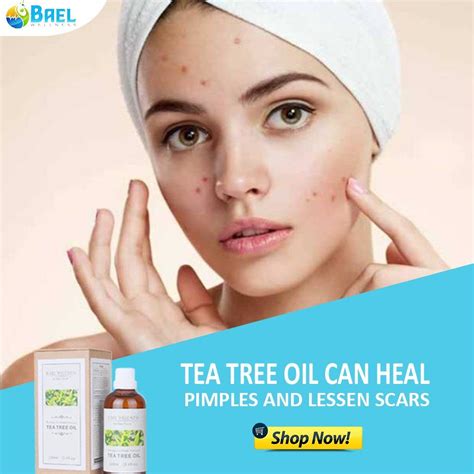 Tea Tree Oil Artofit