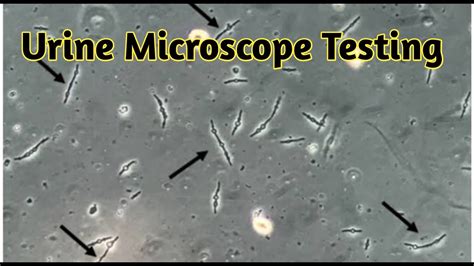 Urine Sediment Microscopy Cat At Helen Cummings Blog