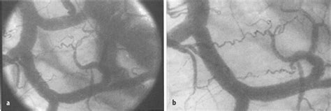 Unedited Orthogonal Polarization Spectral Ops A And Sidestream Dark Download Scientific