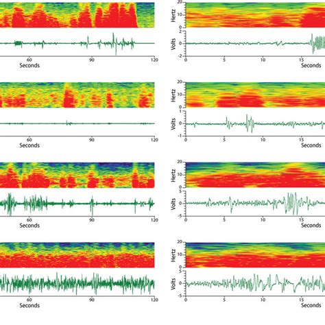 Spectrogram And Voltage Traces Of Wake Non Rem Sleep And Rem Sleep