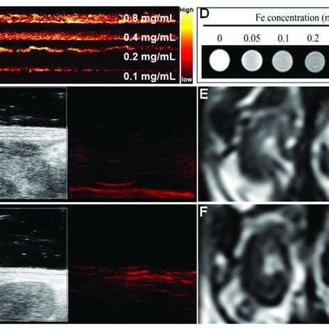 Photoacousticmagnetic Resonance Dual Mode Imaging A Photoacoustic Download Scientific