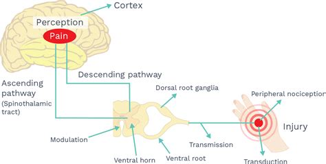 Understanding Pain What Is Nociceptive Pain Square One Active Recovery