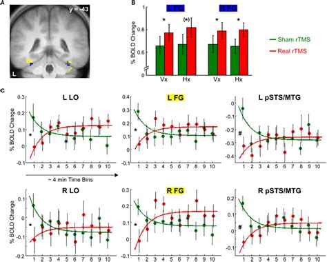 Effects Of Real Rtms On S1 Processing A Activation Map Showing Download Scientific Diagram