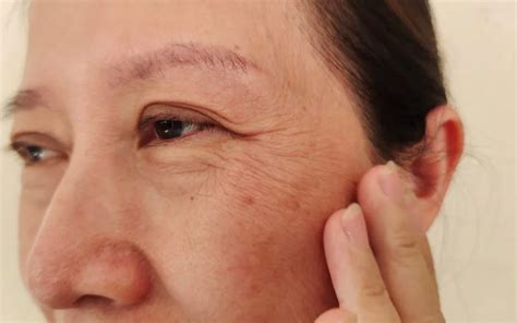 A Wrinkle In Time Static Wrinkles Vs Dynamic Wrinkles Kowayo