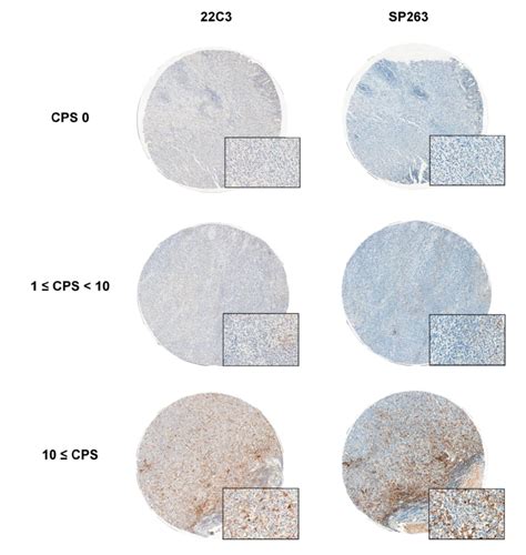 Representative Tumor Microarray Core Stained With The 22c3 Pharmdx And