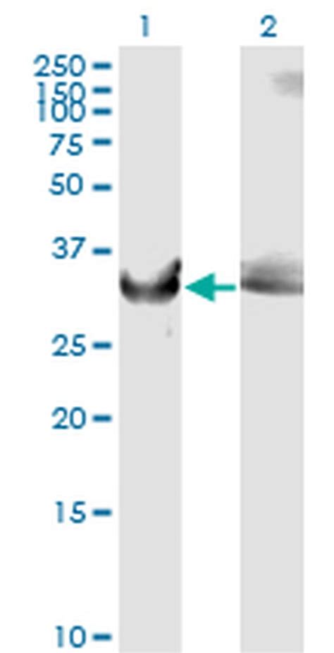 Gapdh Monoclonal Antibody 3c2 H00002597 M01a