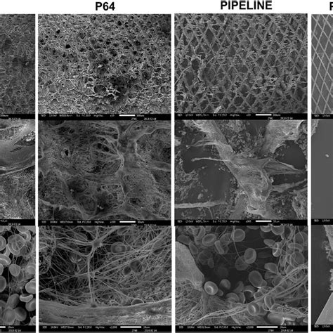 Pdf Thrombogenicity Assessment Of Pipeline Pipeline Shield Derivo