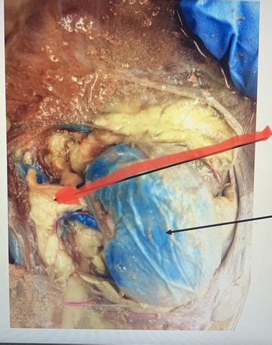 Cat And Human Endocrine And Histology Flashcards Quizlet
