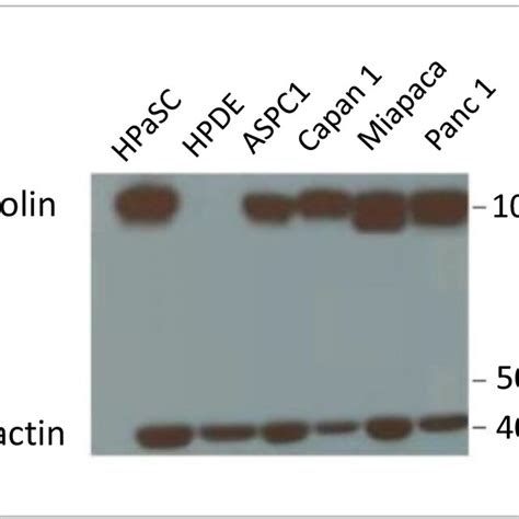 Analysis Of Nucleolin Protein Expressions In Multiple Human Pancreatic Download Scientific