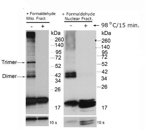 Video Combining Non Reducing Sds Page Analysis And Chemical Crosslinking To Detect Multimeric