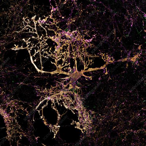 Astrocyte Cells Light Micrograph Stock Image C060 1330 Science Photo Library