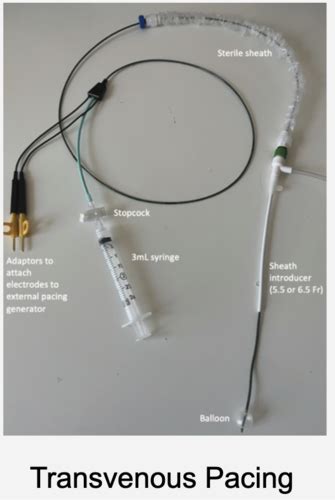 Pacemaker Rhythms Flashcards Quizlet
