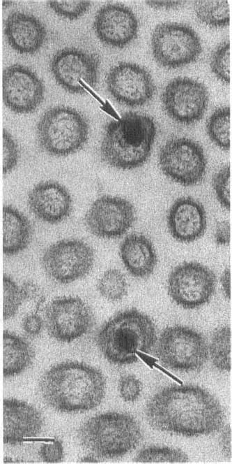 Transmission Electron Micrograph Of A Cross Section Of Microvilli Of