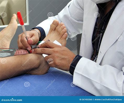 Somatosensory Evoked Potentials Sep Or Nerve Conduction Velocity Ncv Is A Test Of Electrical