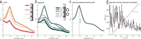 Sunderland Baker ♿️ On Linkedin Comparison Of Beta Peak Detection
