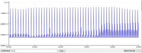 How Can I Interpret This Result From ECG Sensor Sensors Arduino Forum