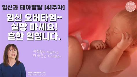 임신과 태아발달 시리즈 41 임신 오버타임~ 실망마세요 흔한 일입니다 임신41주차 Youtube