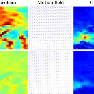 The Jacobian Determinant First Column Motion Vector Field Second Download Scientific