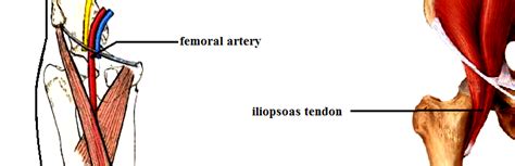 Mri Arthrogram Hip Protocol And Planning Indications For Mri