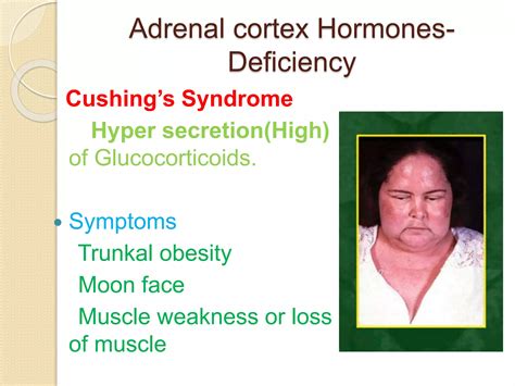 Adrenal Gland Pptx