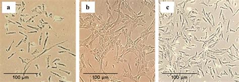 Primary Human Astrocyte Isolation A The Primary Cells Suspension Of Download Scientific