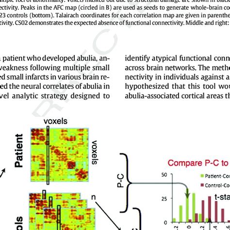 Flair Aberrant Functional Connectivity Afc Map And Correlation Maps