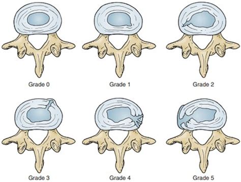 Full Article A Primer On Anatomy Biophysics Pathology Imaging And