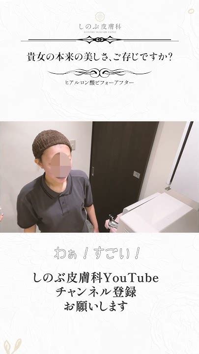【整形しないコンプレックス治療】横顔を見られたくない。26歳女性の本来の美しさを引き出す｜ヒアルロン酸ビフォーアフター Shorts
